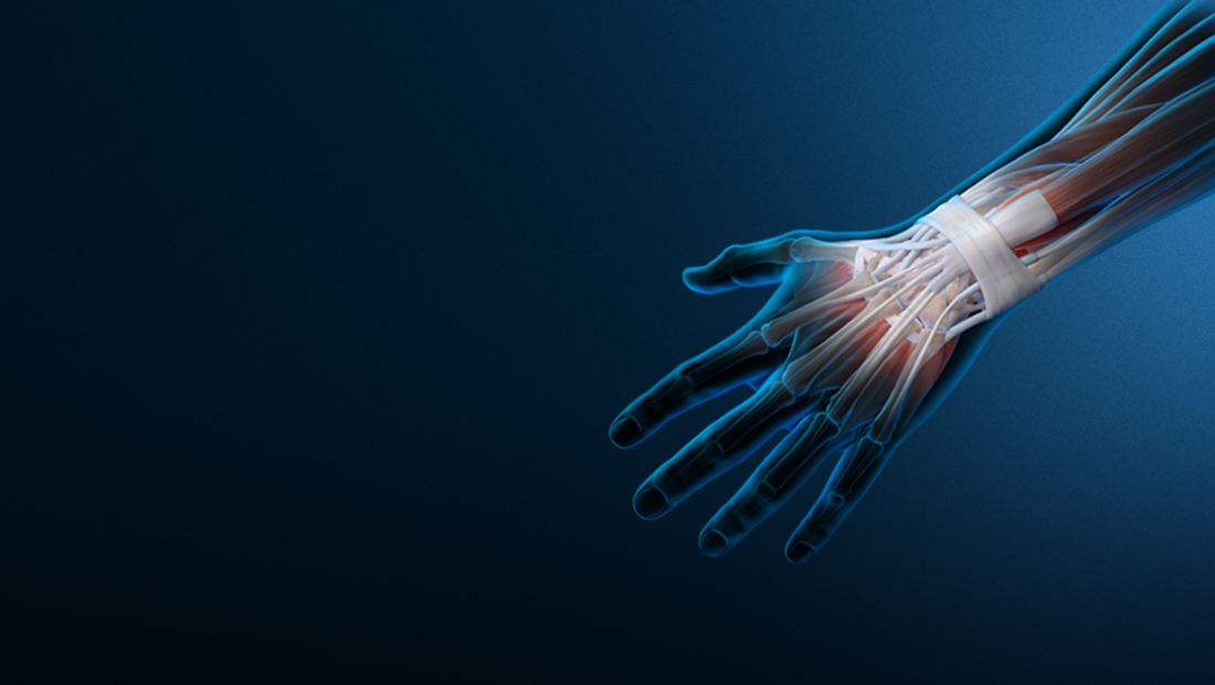 Hand and Wrist : Orthopedia Academics