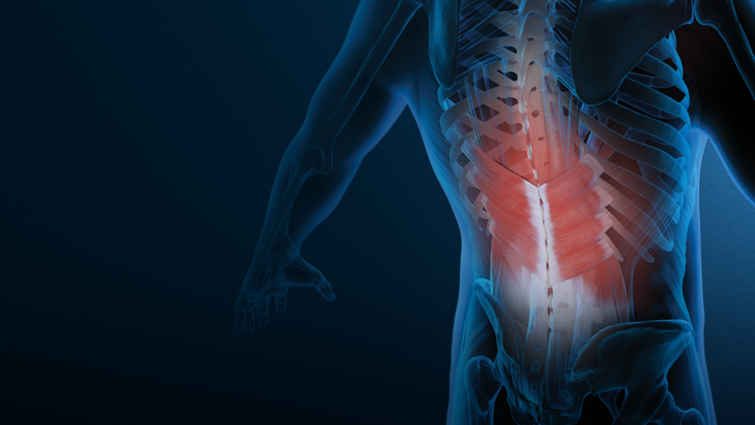 Spine : OrthoPedia Academics