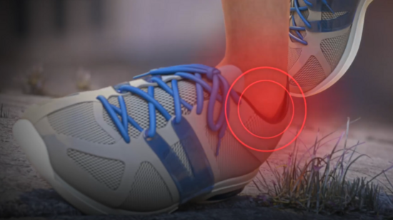 Lateral Ankle Instability : OrthoPedia