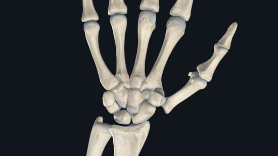 Thumb Carpometacarpal (CMC) Dislocation (Non-Arthritic) : OrthoPedia