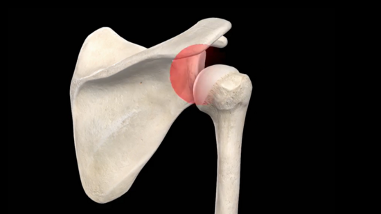 Posterior Glenohumeral Joint Instability : OrthoPedia