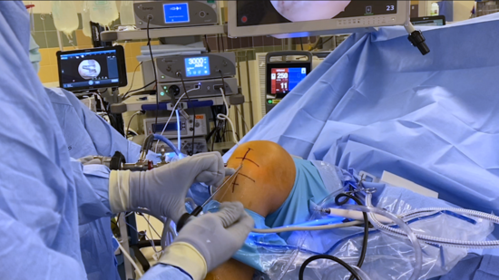 Dr. Maak Demonstrates Tips and Pearls for Knee Arthroscopy ...
