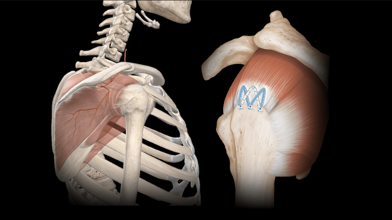 Biomechanics of the Shoulder With a Rotator Cuff Tear: General : OrthoPedia