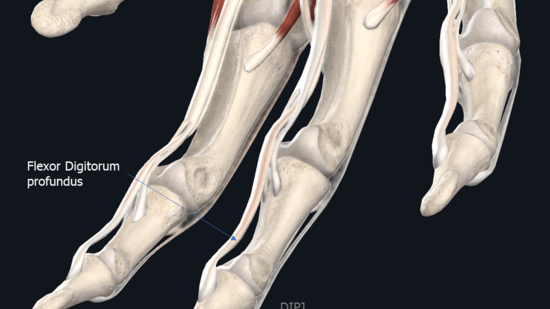 Palmar Distal Interphalangeal (DIP) Joint Injuries (Jersey Finger ...
