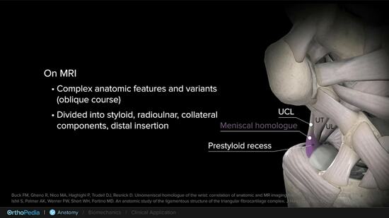 Anatomy of the Wrist With Triangular Fibrocartilage Complex Injury ...