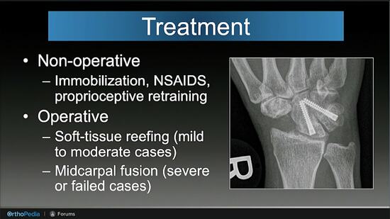 Hand and Wrist Fellowship Forum: Midcarpal Instability : OrthoPedia