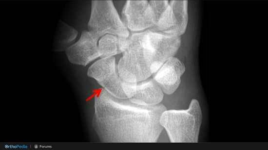 NanoScope™ Operative Arthroscopy System and Minimally Invasive Hand ...