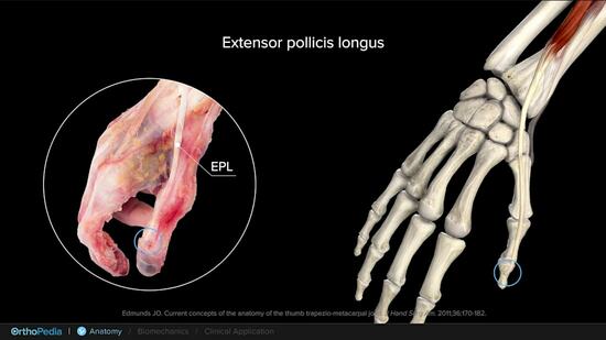 Open Anatomy of the Hand and Wrist With Thumb CMC Arthritis : OrthoPedia