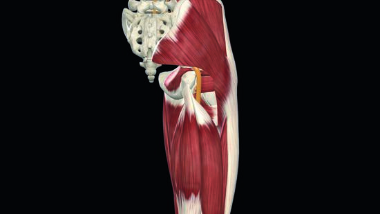 Proximal Hamstring Tears: Knotless Repair Using the SpeedBridge ...