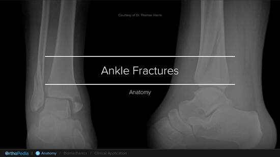 Anatomy of the Ankle With an Ankle Fracture : OrthoPedia