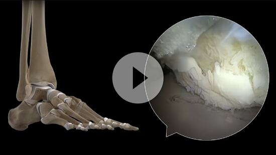 Anatomy of the Ankle With Arthroscopy : OrthoPedia