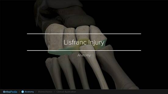 Anatomy of the Foot With Lisfranc Injuries : OrthoPedia