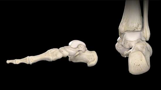 Biomechanics of the Foot and Ankle With Flatfoot Deformity Stages III ...