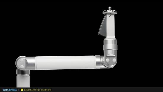 Dr. Martin Demonstrates Tips and Pearls for Calcaneal Fractures ...