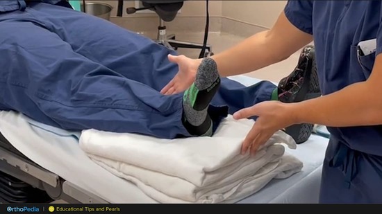 Dr. Millonig Demonstrates Tips and Pearls for General Foot and Ankle ...