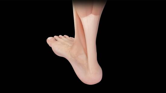 Dr. Patton Demonstrates Tips and Pearls for Achilles Pathology: Draw ...