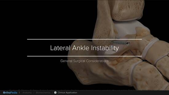 Lateral Ankle Ligament Injuries: General Surgical Considerations ...