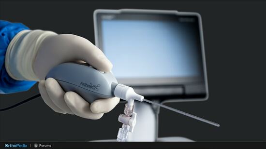 Nano Arthroscopy—The One Tool I Can't Live Without: Part 1—Using the ...