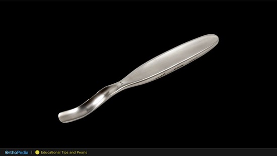 Dr. Garcia Demonstrates a Surgical Tip for Performing a Trapeziectomy ...