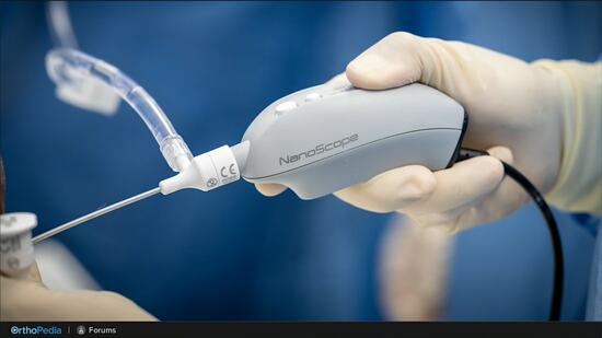 NanoScope™ Operative Arthroscopy System and Minimally Invasive Hand ...