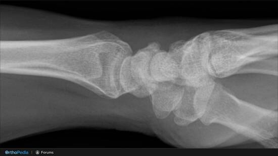 NanoScope™ Operative Arthroscopy System and Minimally Invasive Hand ...