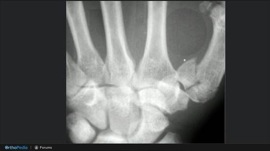 NanoScope™ Visualization System, Trauma, and Minimally Invasive Hand ...