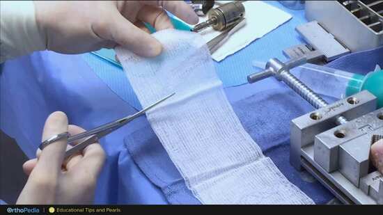 Dr. Caldwell Demonstrates Tips and Pearls for Osteochondral Defects of ...