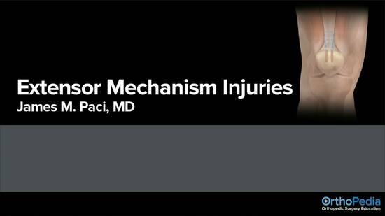 Managing Patellofemoral Pathology: Part 2–Extensor Mechanism Injuries ...