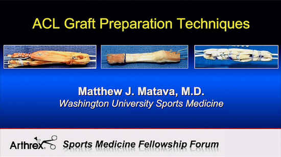 Graft Preparation Techniques for ACL Reconstruction : OrthoPedia