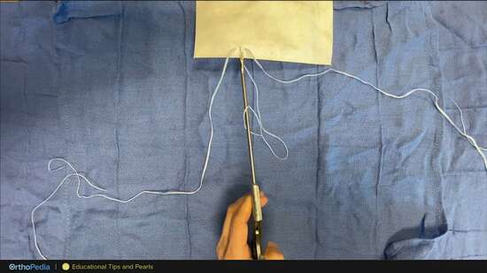 Dr. Phipatanakul Demonstrates Tips and Pearls for Shoulder Arthroscopy ...