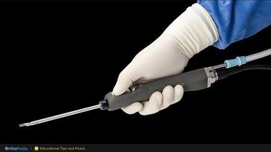 Dr. Yagnik Demonstrates Tips and Pearls for Rotator Cuff Tears: Glenoid ...