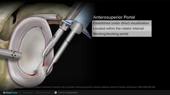 Glenohumeral Joint Instability: General Surgical Considerations ...