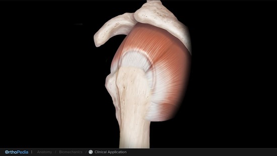 Posterosuperior Rotator Cuff Tears: Rotator Cable Reconstruction ...