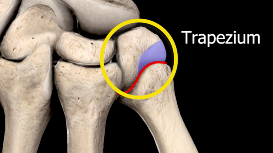 Thumb Arthritis : OrthoPedia Patient