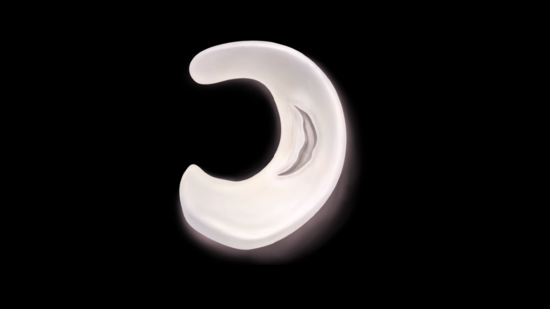 Meniscus Tears : OrthoPedia Patient