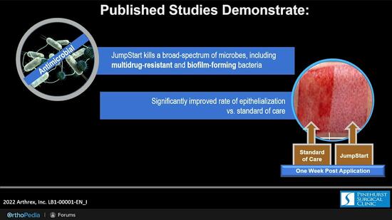 Spine Evolutions: Preventing Post-op Infections : OrthoPedia