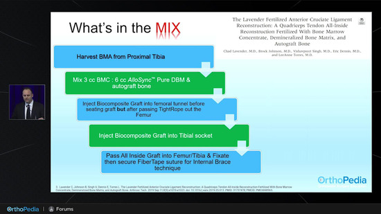 OTIF: Augmenting ACL Sockets with Demineralized Bone Matrix : OrthoPedia