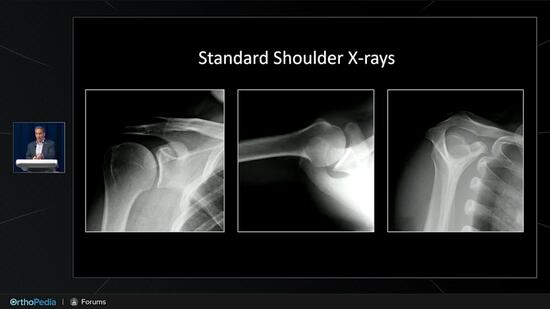 Simplified Approach to Shoulder Imaging : OrthoPedia