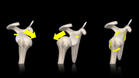Multidirectional Glenohumeral Joint Instability (MDI) : Orthopedia ...
