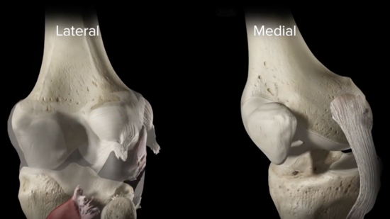 Collateral Ligament Injuries : Orthopedia Academics