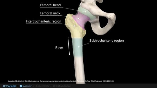 Anatomy of the Proximal Femur With Subtrochanteric Fractures : OrthoPedia