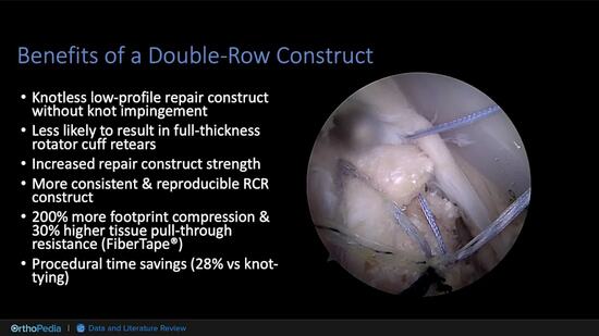 Rotator Cuff Tears: Literature Review on Double-Row Rotator Cuff ...