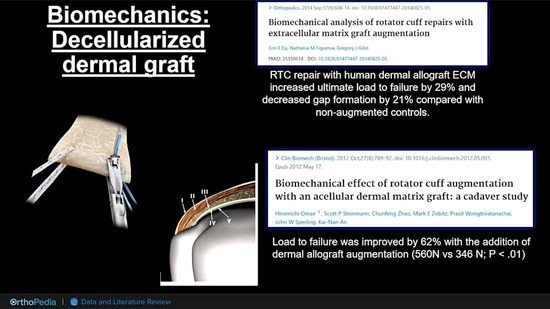 Rotator Cuff Tears: Literature Review on Graft Options for Rotator Cuff ...