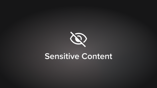 Triangular Fibrocartilage Complex (TFCC) Tears: Ulnar Tunnel Foveal ...