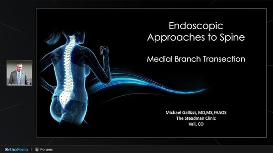 Endoscopic Approaches to Spine: Medial Branch Transection : OrthoPedia