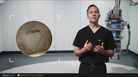 Dr. Menge Demonstrates Tips and Pearls for Hip Labral Tears: Suture ...